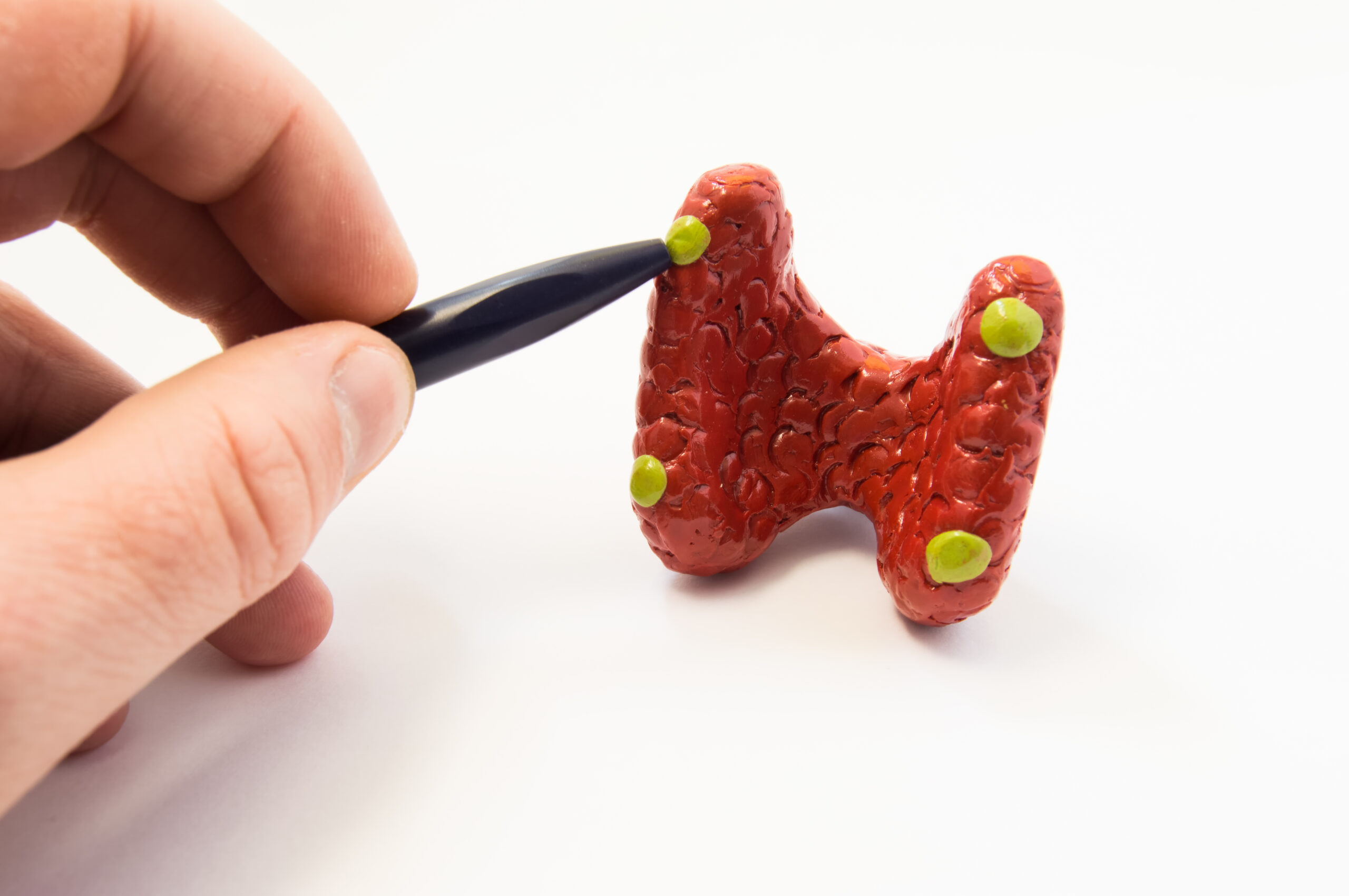 What is primary hyperparathyroidism? | Dr Meei Yeung